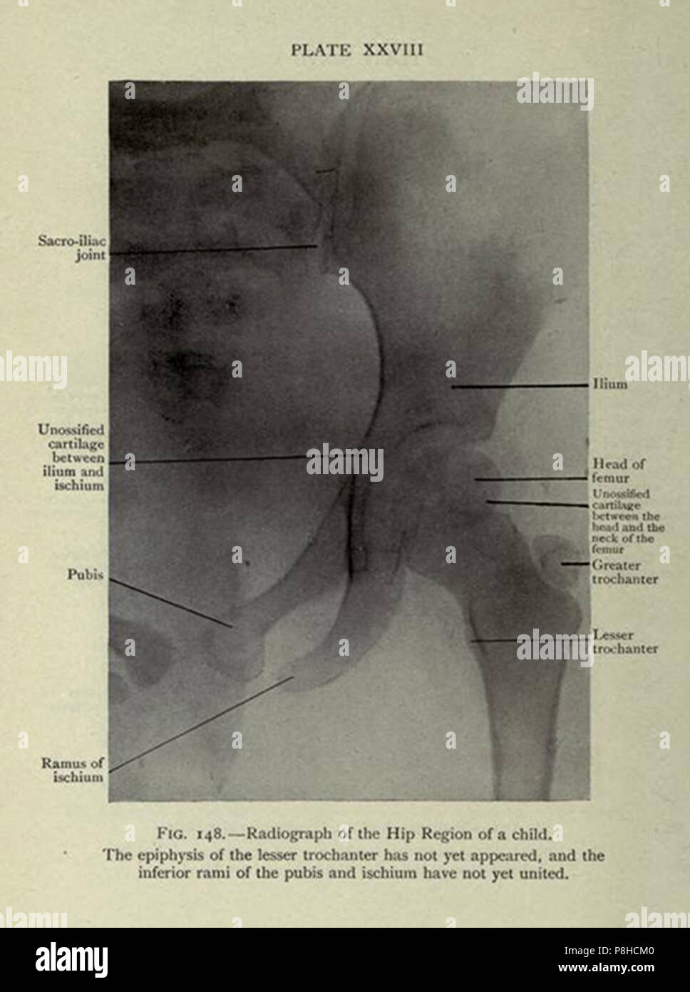 vintage radio graphic x-ray plate annotated Stock Photo - Alamy