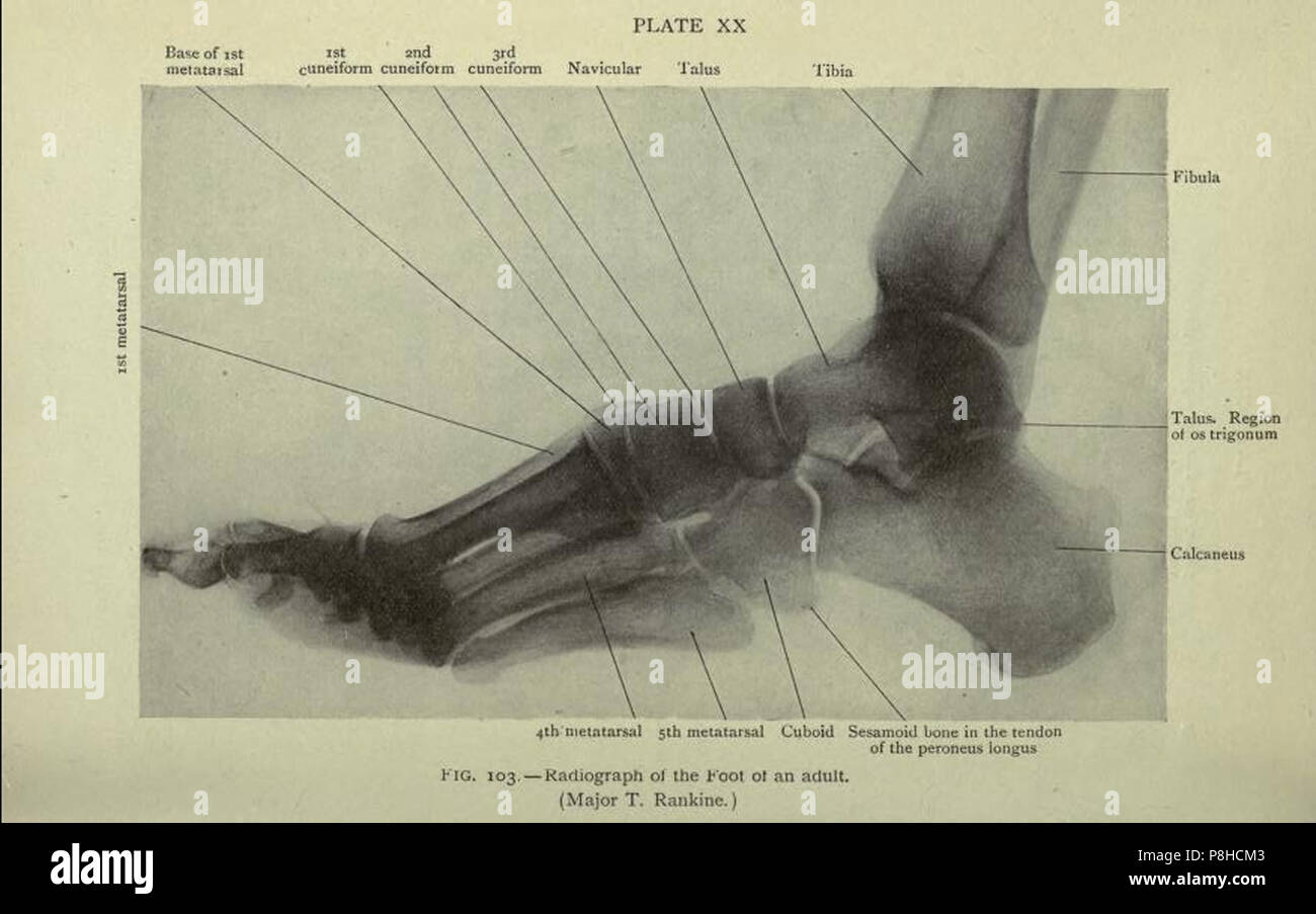 vintage radio graphic x-ray plate annotated Stock Photo - Alamy