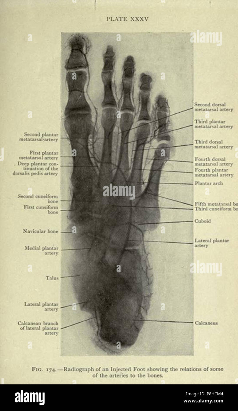 vintage radio graphic x-ray plate annotated Stock Photo - Alamy