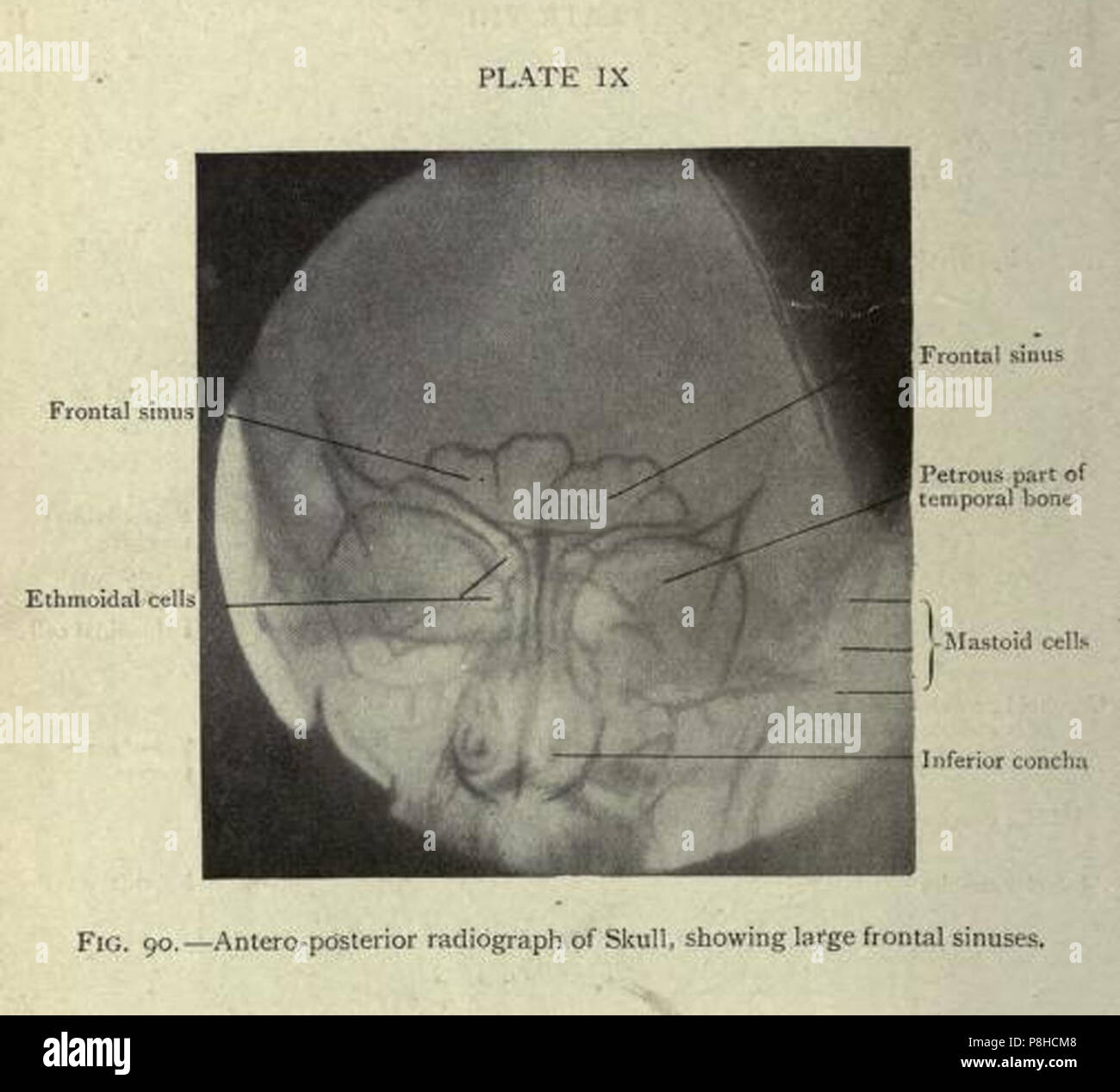 Xray radiographic hi-res stock photography and images - Alamy