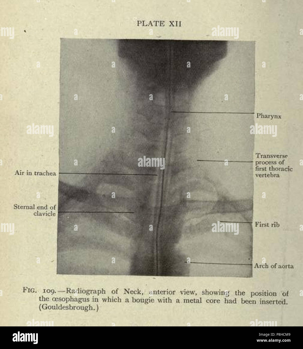 Xray radiographic hi-res stock photography and images - Alamy