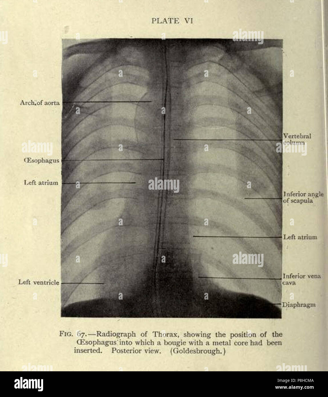 vintage radio graphic x-ray plate annotated Stock Photo - Alamy