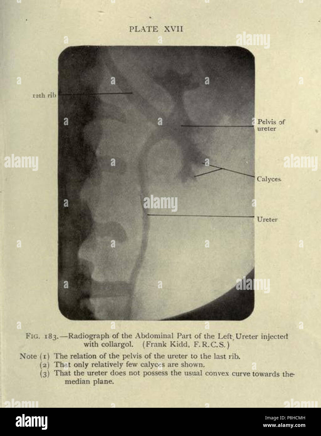 vintage radio graphic x-ray plate annotated Stock Photo - Alamy
