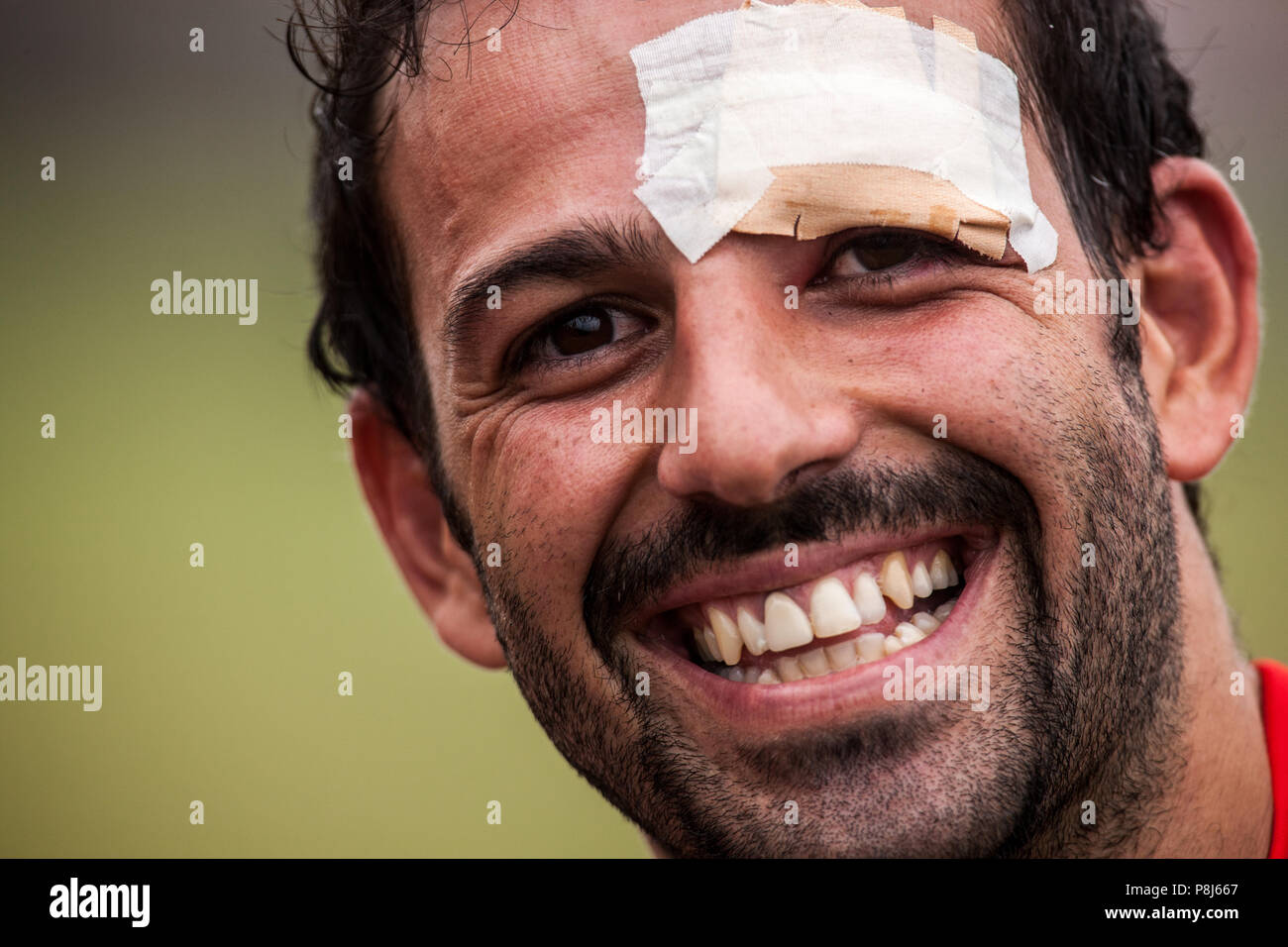 POINTNOIRE/CONGO - 18MAY2013 - Expressive portrait of injured rugby ...