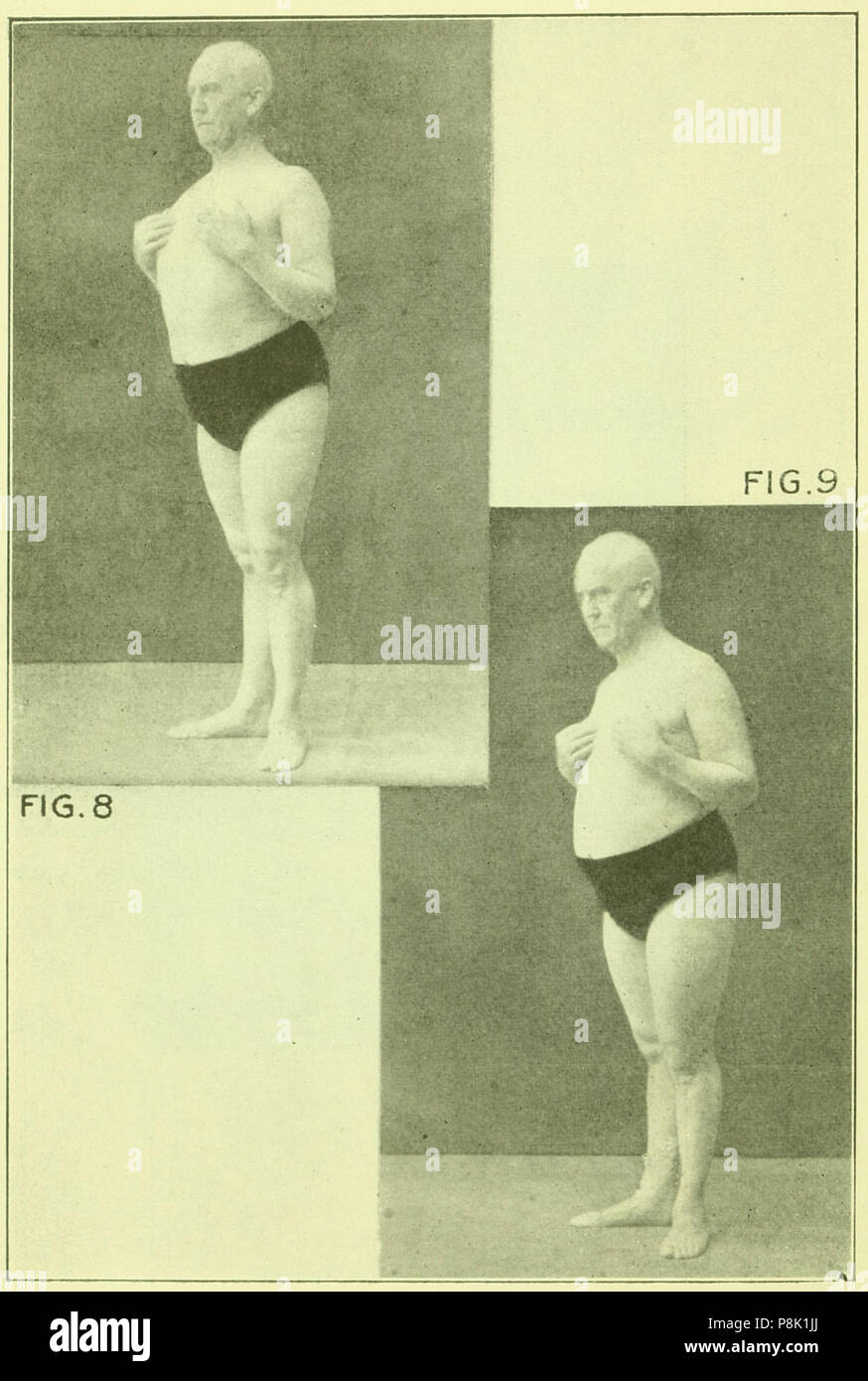 . 552 Tensing Exercises Fig08 Stock Photo - Alamy