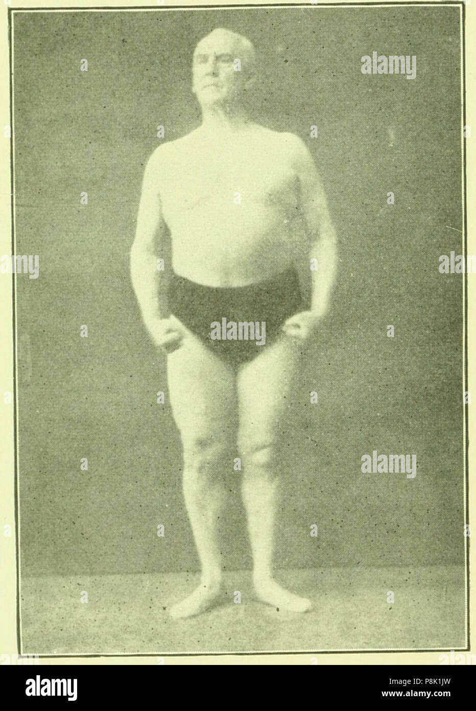 . 552 Tensing Exercises Fig17 Stock Photo - Alamy