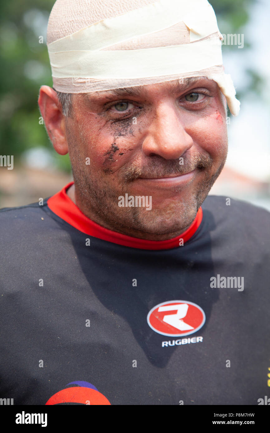 Injured rugby player hi-res stock photography and images - Alamy