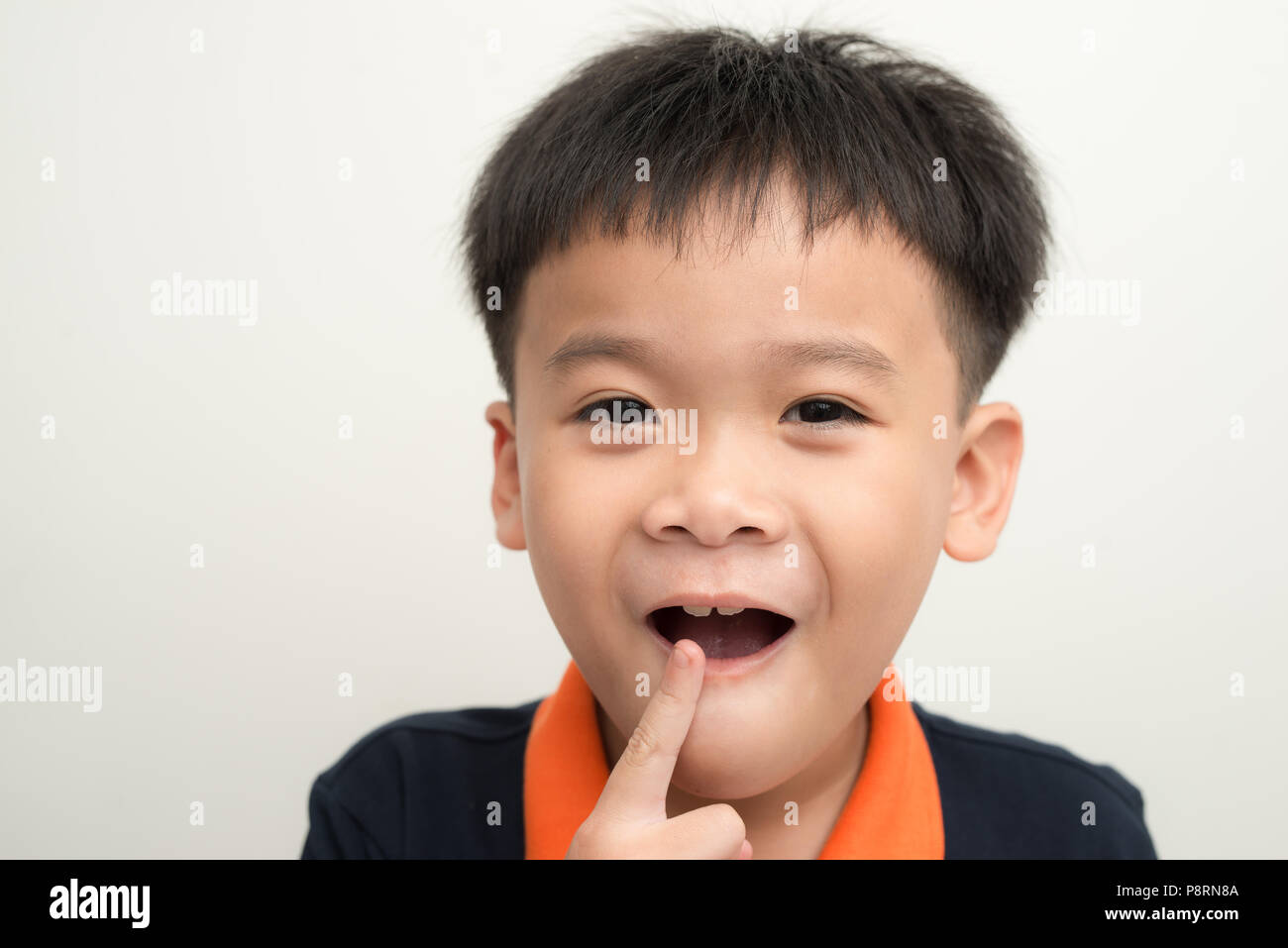 Baby teeth hi-res stock photography and images - Alamy