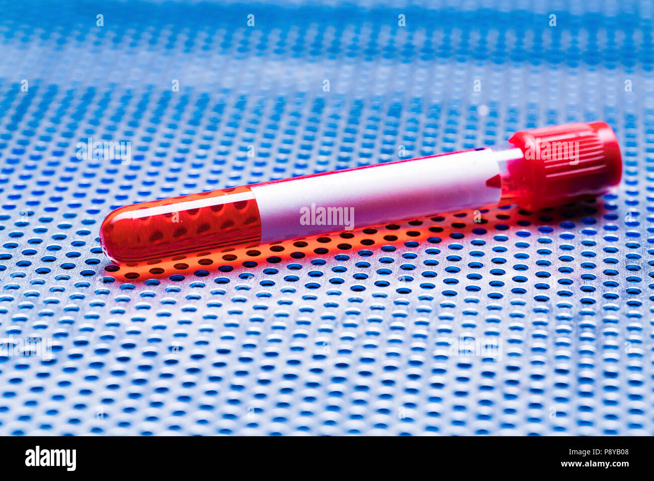 Blood sample label hi-res stock photography and images - Alamy