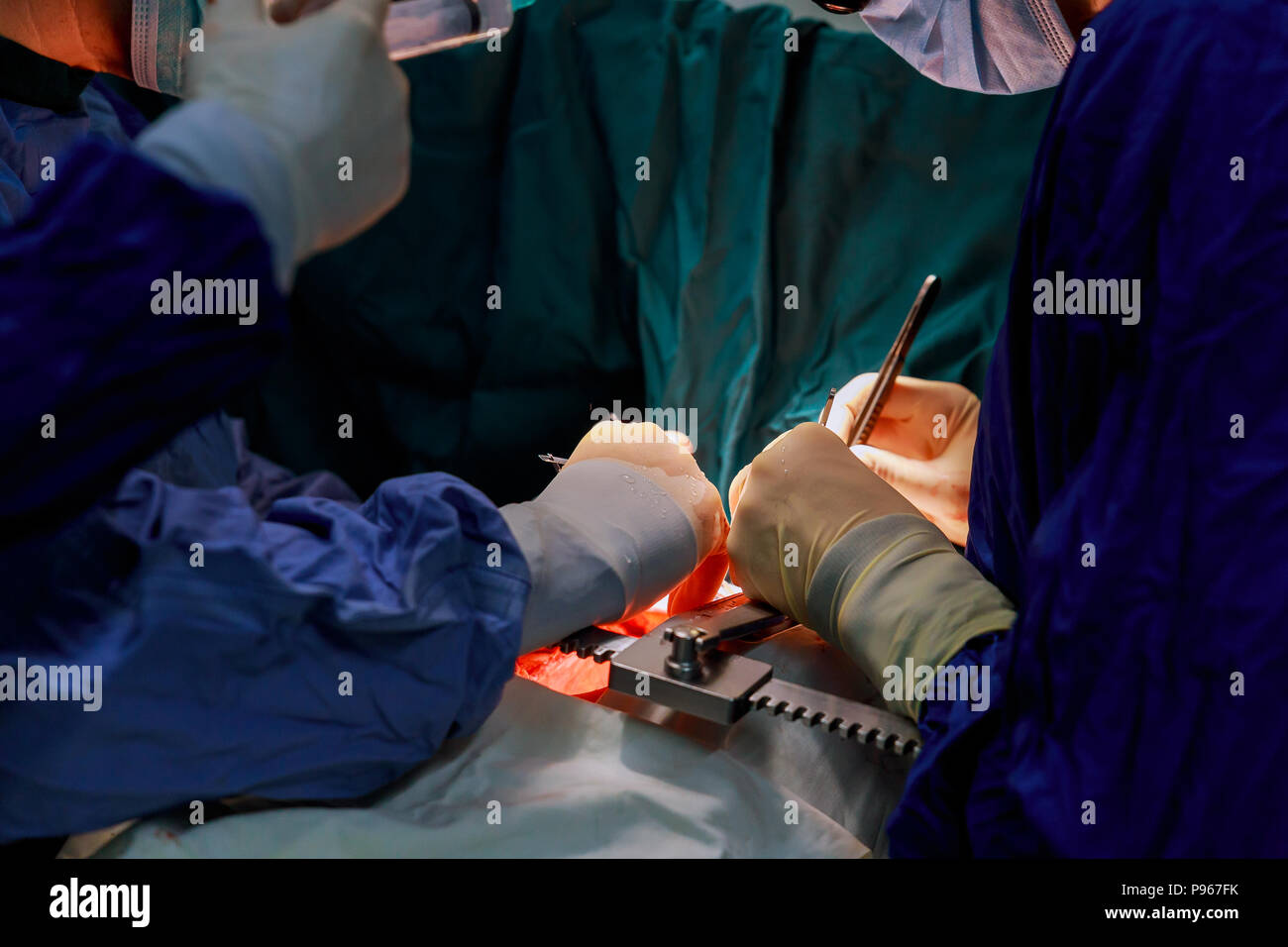 Hypertrophy muscle hi-res stock photography and images - Alamy