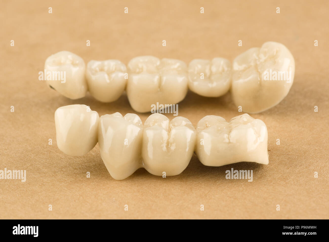 artificial dental structures made of ceramics for restoration of ...