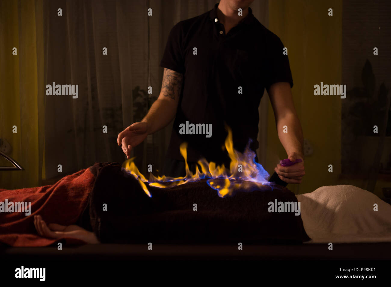 Chinese fire massage and therapy Stock Photo - Alamy