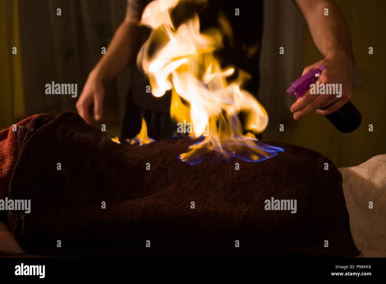 Chinese fire massage and therapy Stock Photo - Alamy
