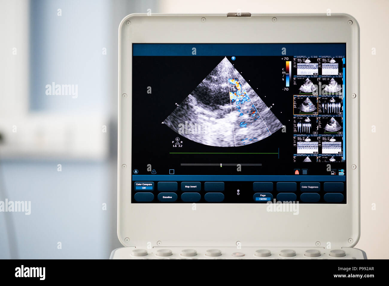 Screen of an ultrasound device with a heart scan. Using the Doppler ...