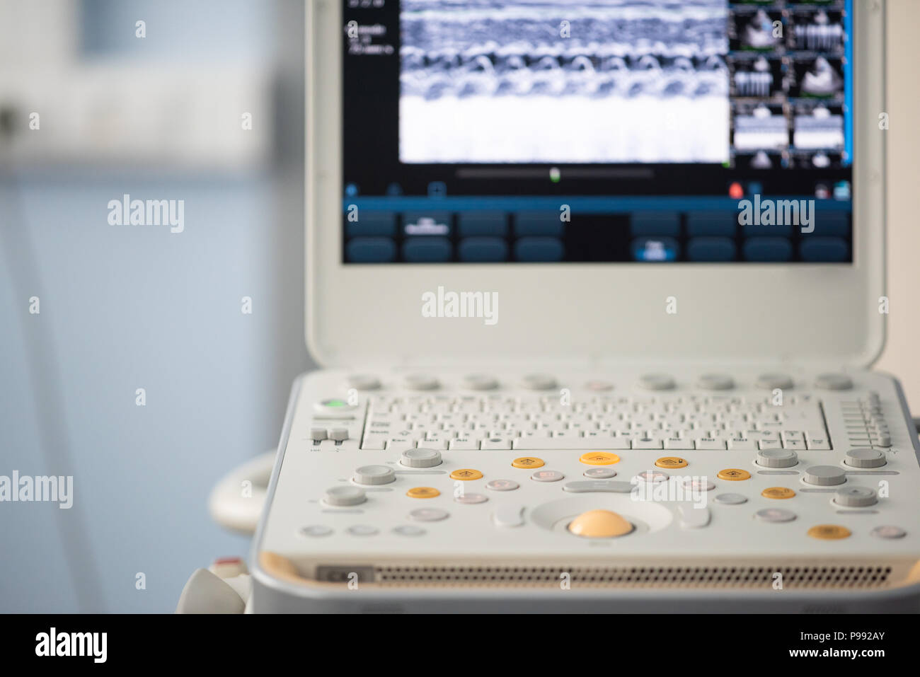 Echocardiogram m hi-res stock photography and images - Alamy