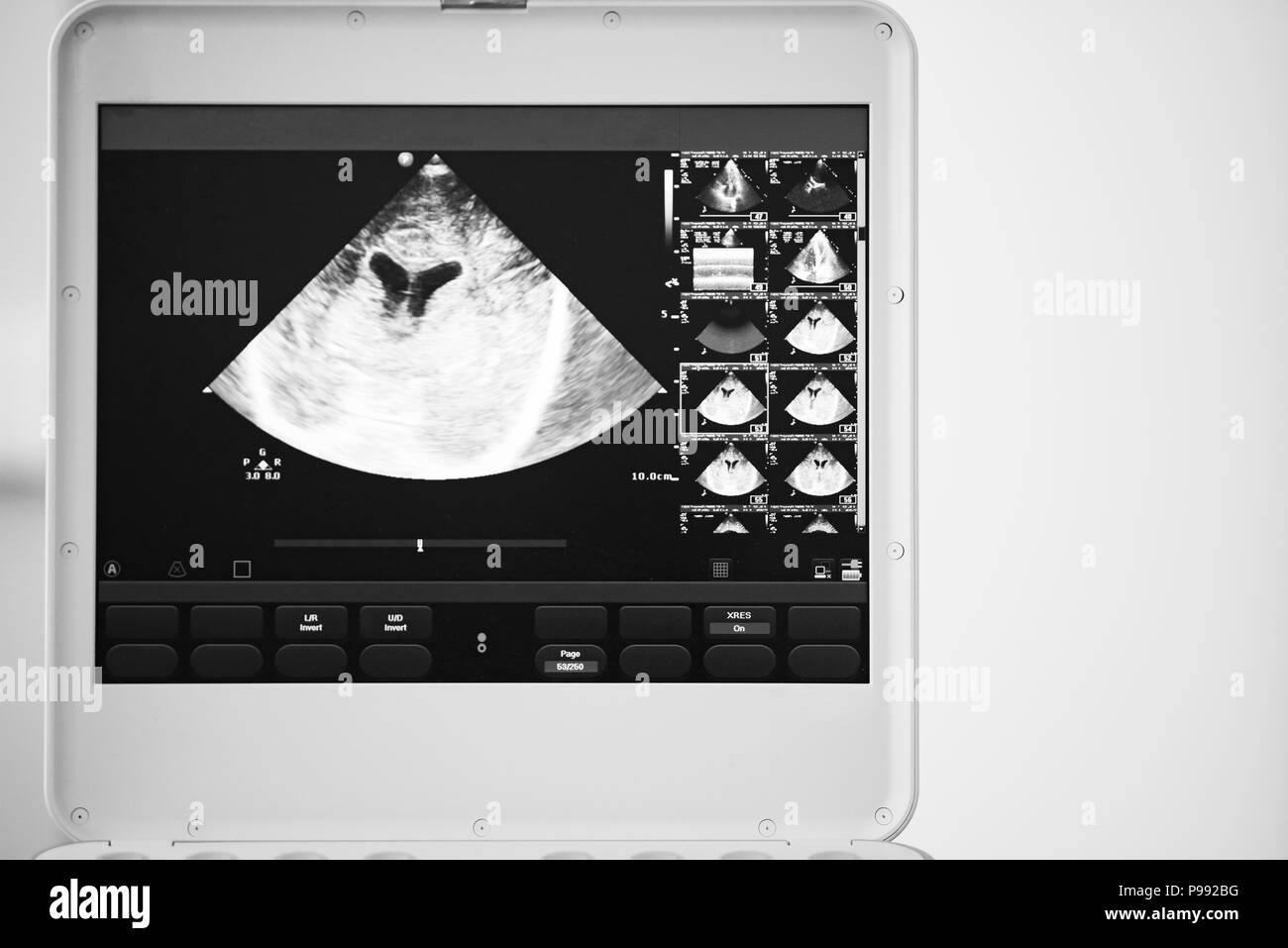Brain scan computer screen Black and White Stock Photos & Images - Alamy
