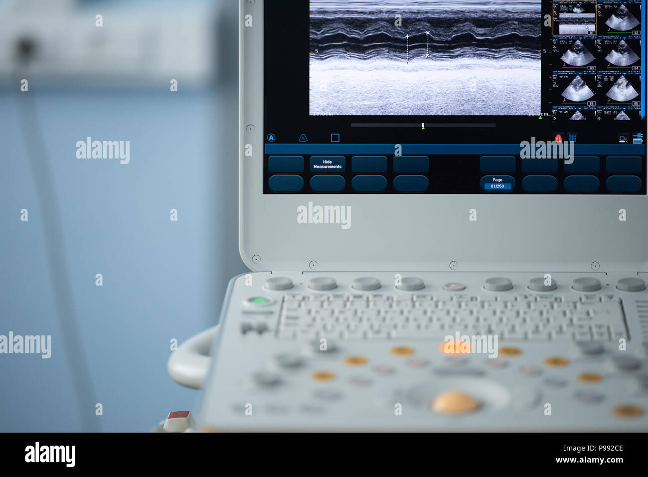 On the screen of the ultrasound apparatus, the scan of the left ...