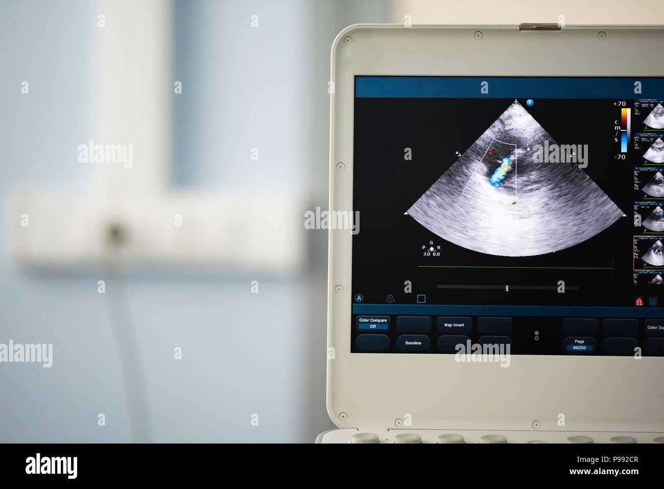 On the screen of the ultrasound device, a heart scan in a four-chamber ...