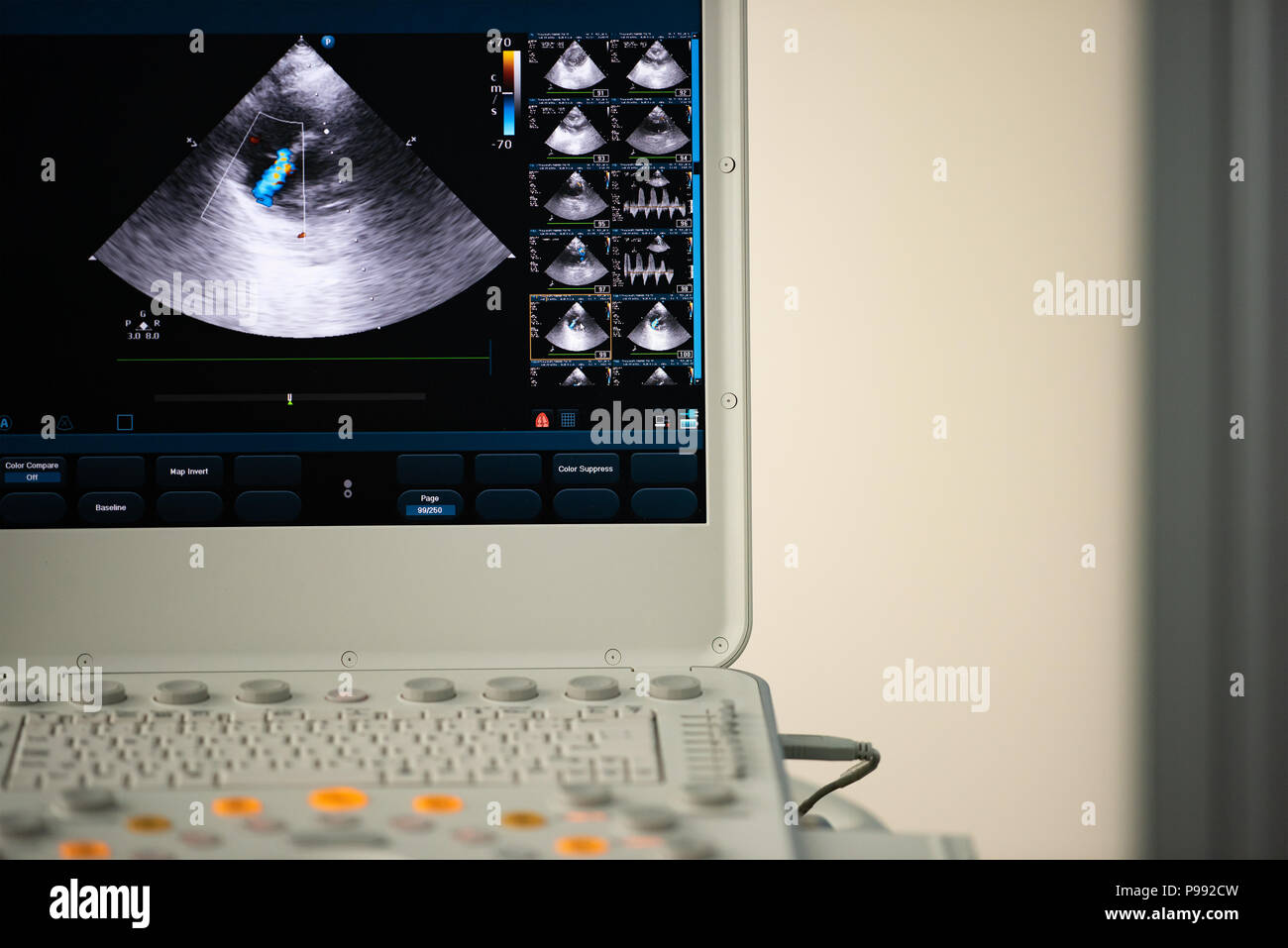 On the screen of the ultrasound device, a heart scan in a four-chamber ...