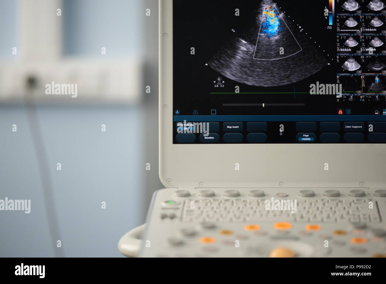 On the screen of the ultrasound device, a heart scan in a four-chamber ...