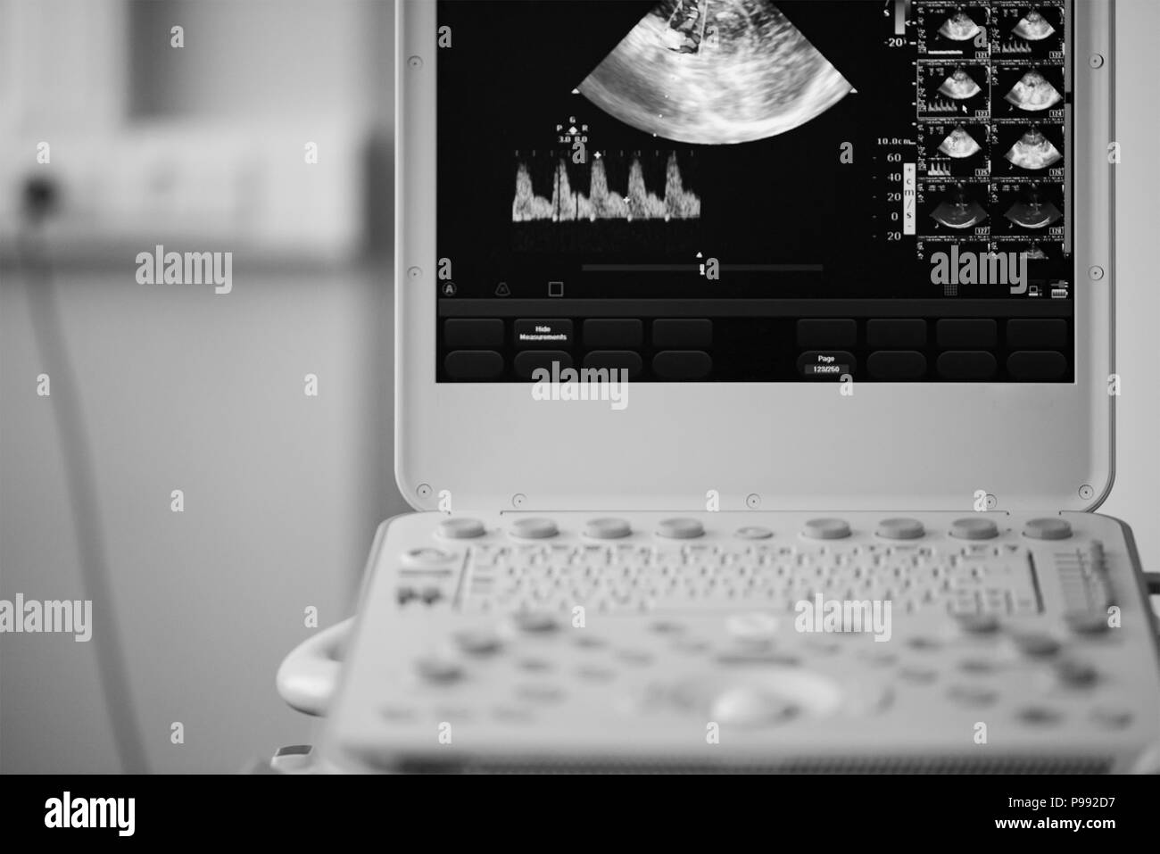 Ultrasound machine Black and White Stock Photos & Images - Alamy