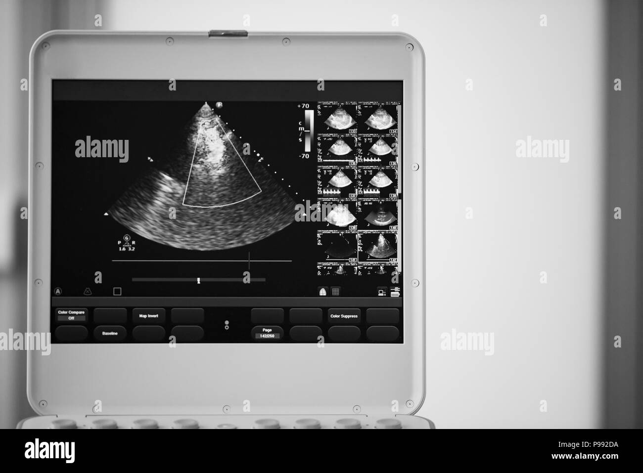 On the screen of the ultrasound device, a heart scan in a four-chamber ...