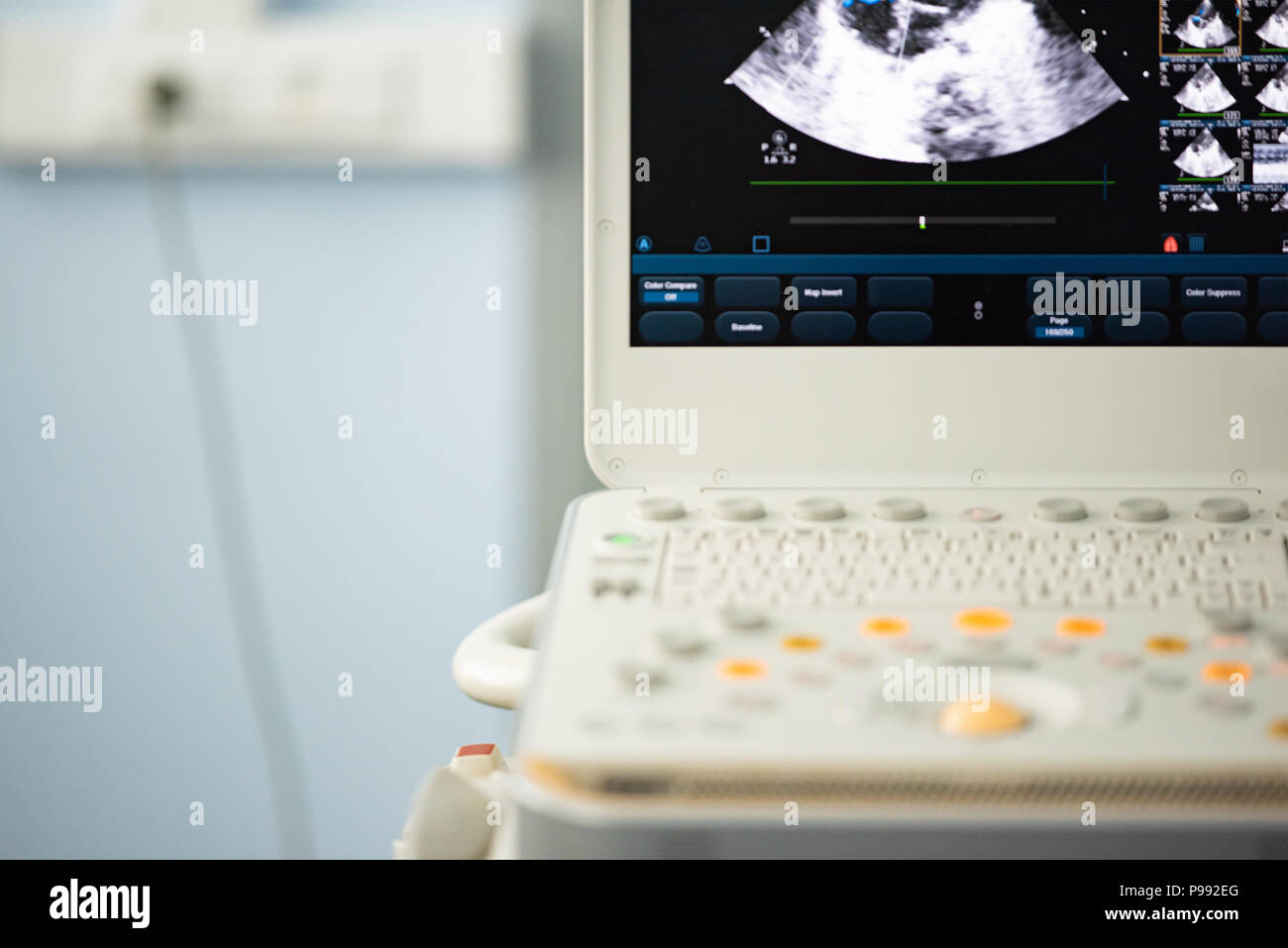 Cardiac septum hi-res stock photography and images - Alamy