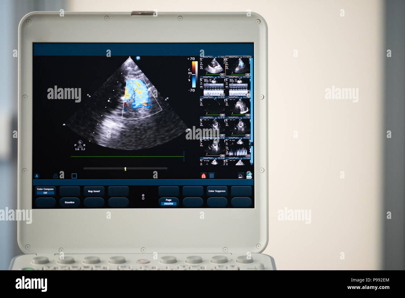On the screen of the modern ultrasound scanner, the image of the right ...