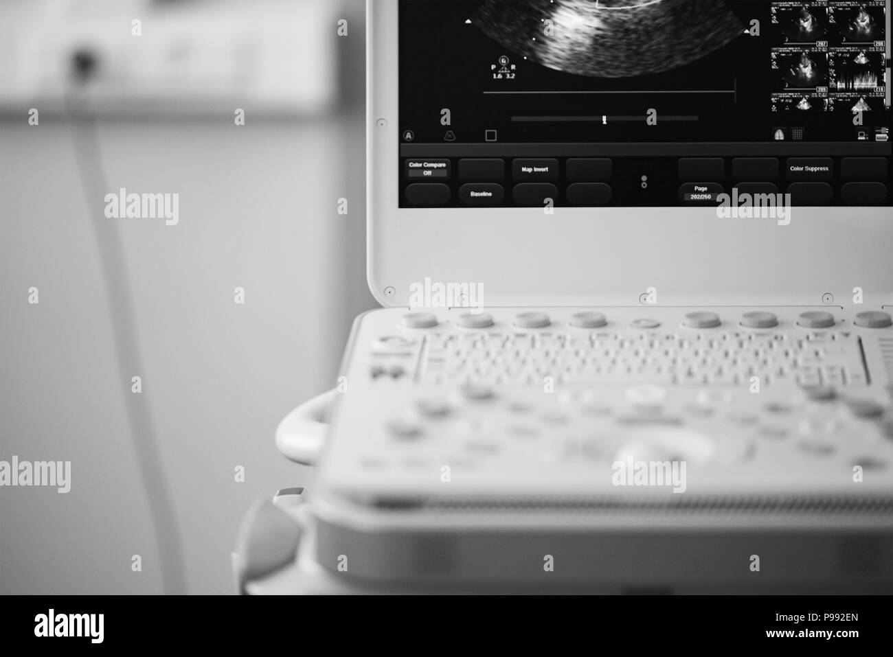 Screen, control panel and keyboard of modern ultrasound scanner after ...