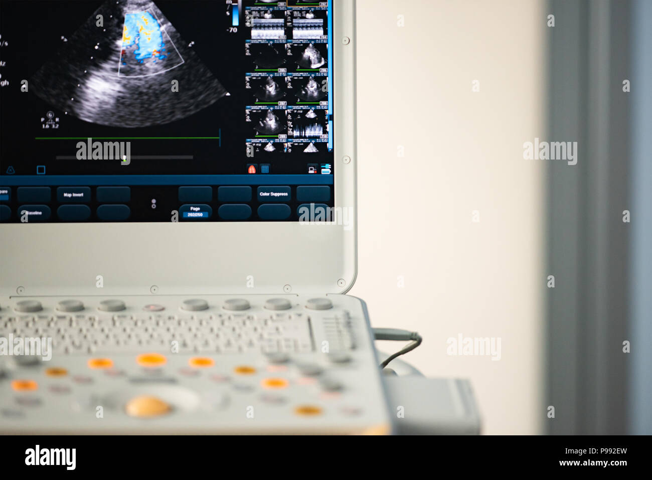 Screen, control panel and keyboard of modern ultrasound scanner after ...