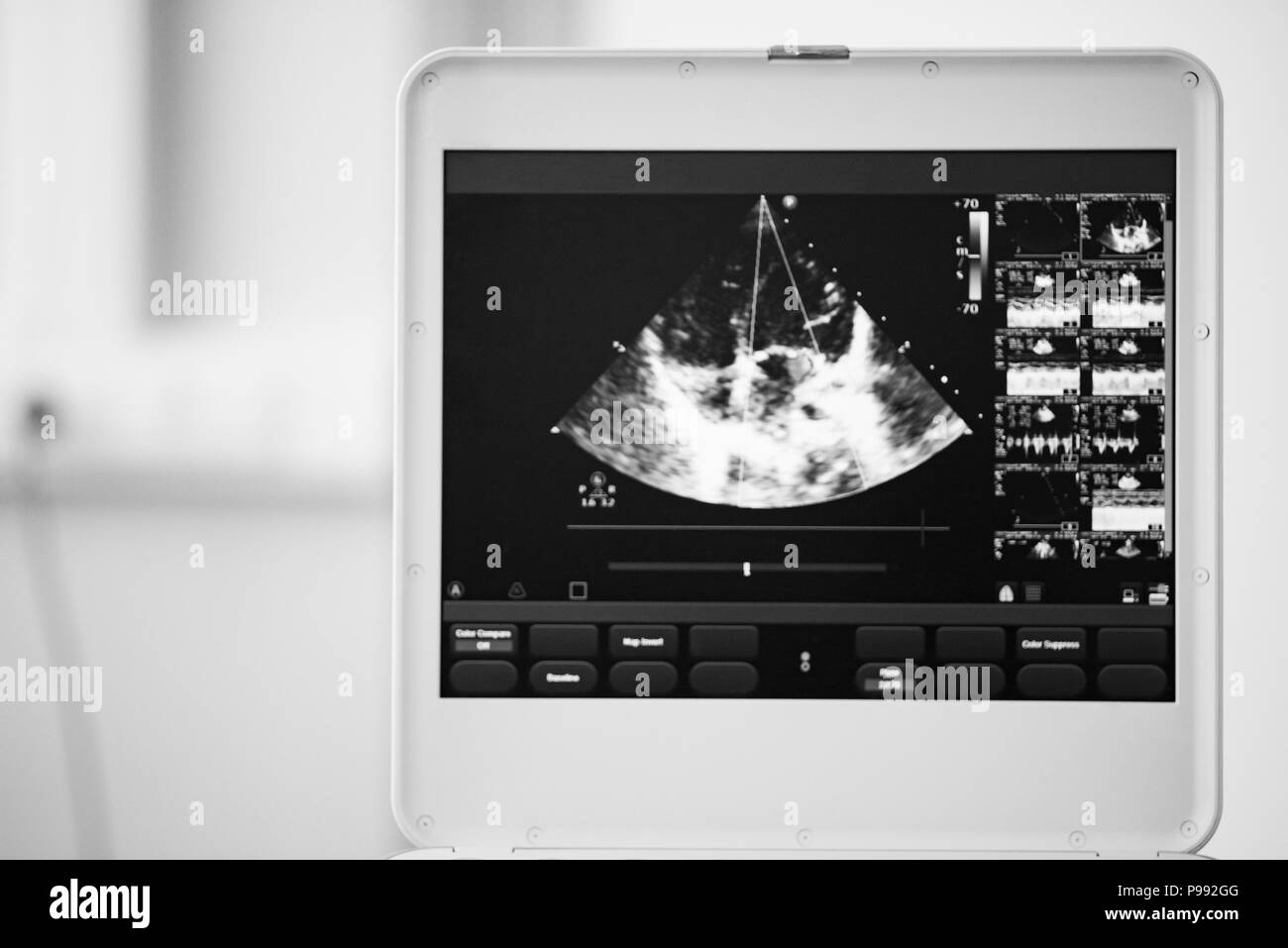 Echocardiogram procedure hi-res stock photography and images - Alamy