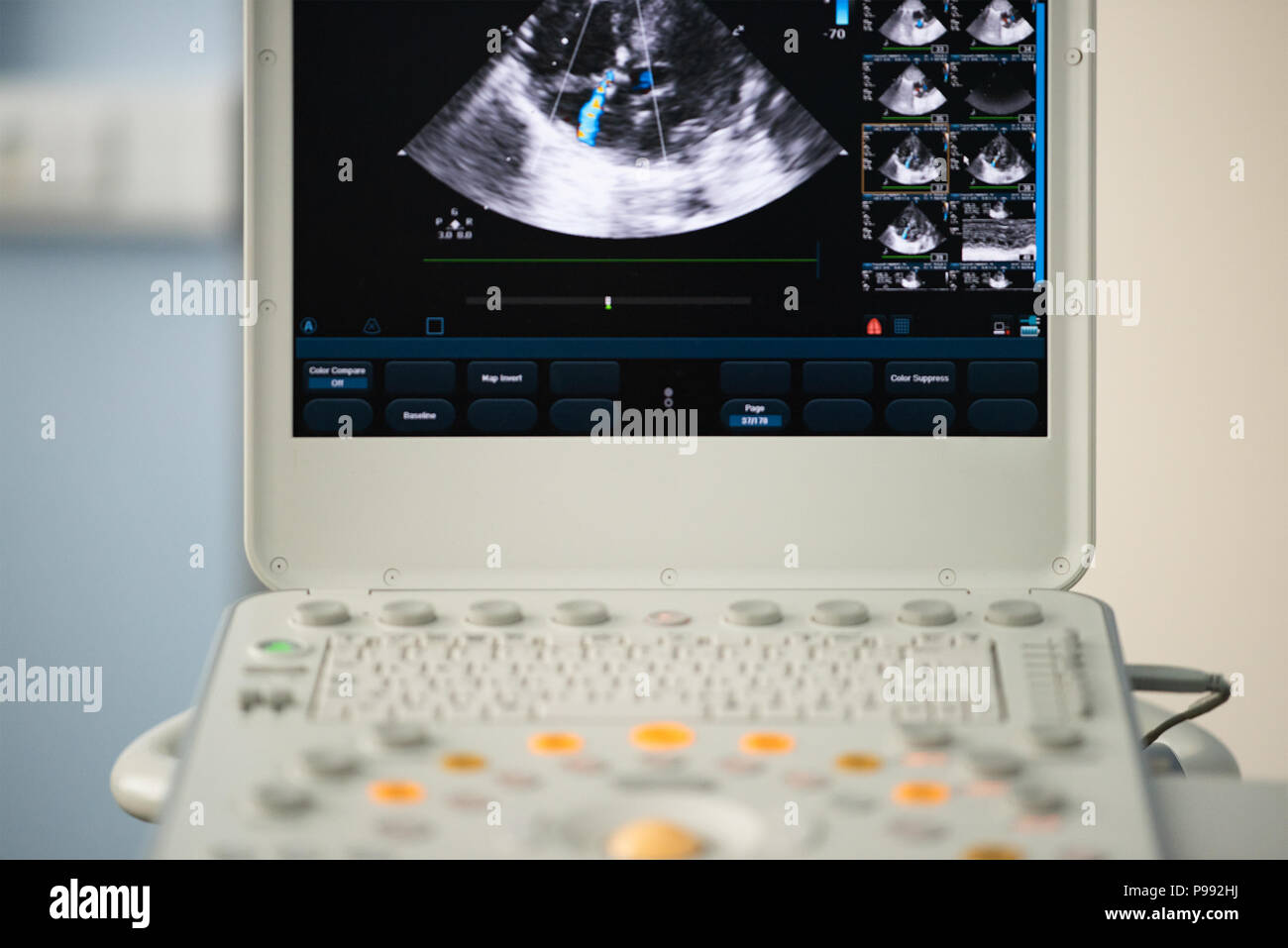 On the screen of the ultrasound scanner, the heart image in the four ...