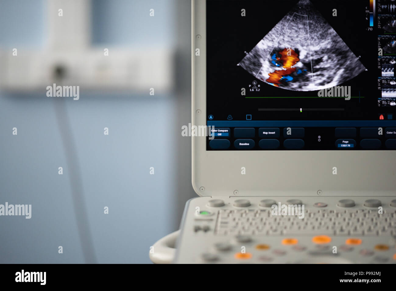 Doppler flow hi-res stock photography and images - Alamy