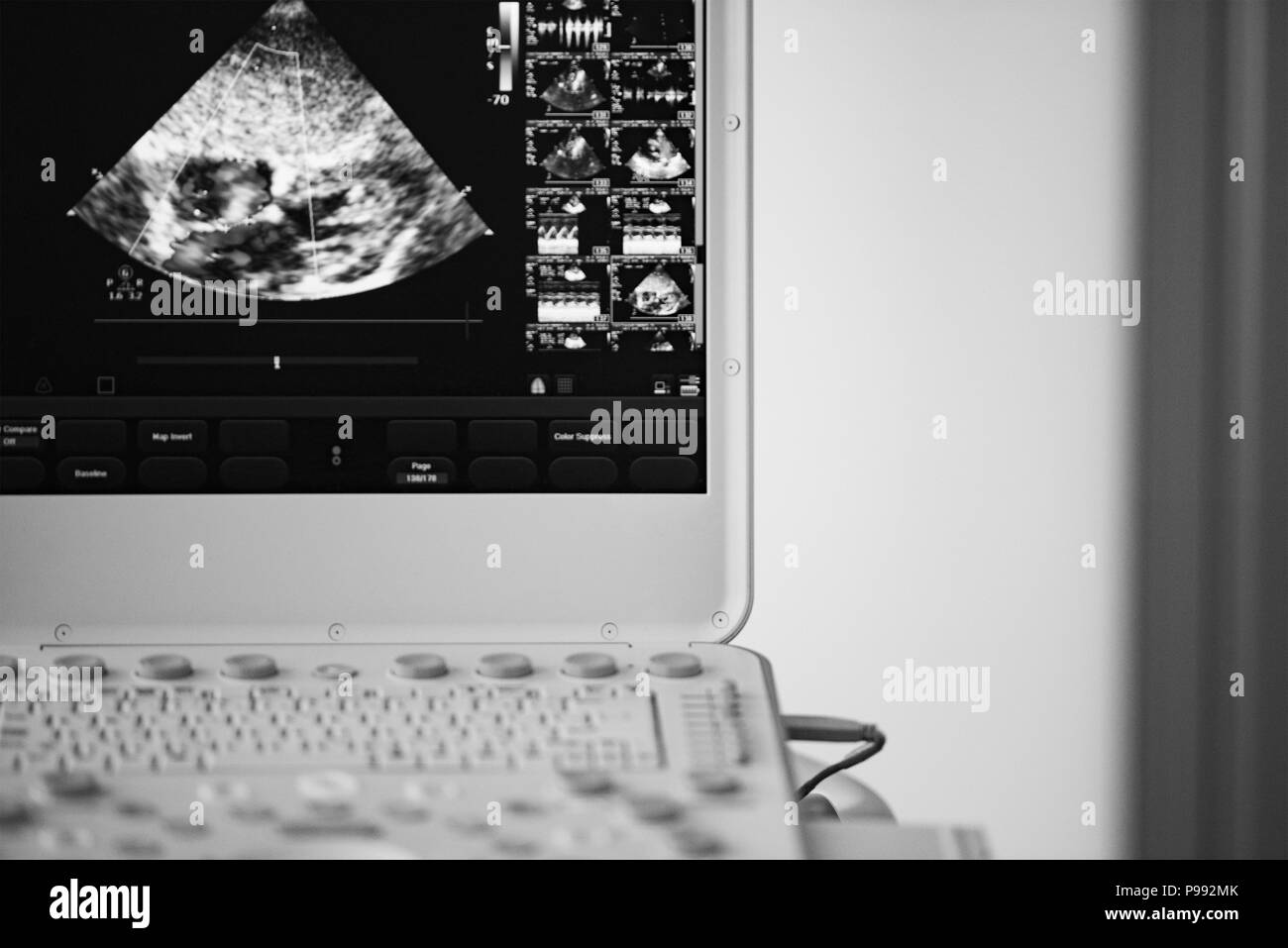 On the screen of a modern ultrasound scanner, a heart image with an ...