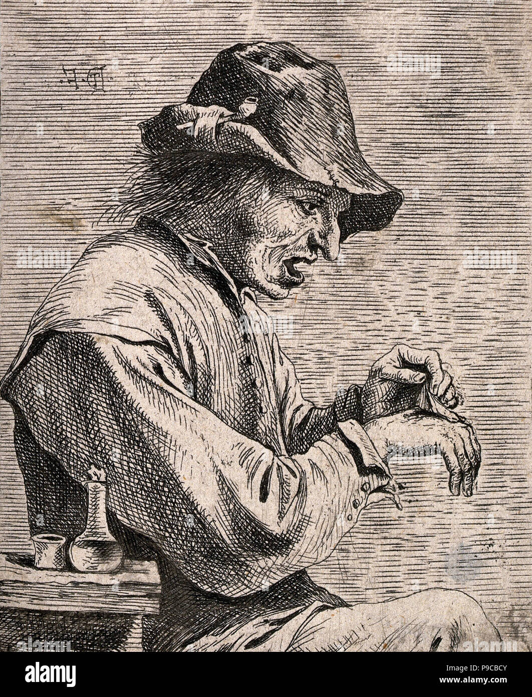 A man removing a plaster from his hand. Etching attributed t Wellcome ...