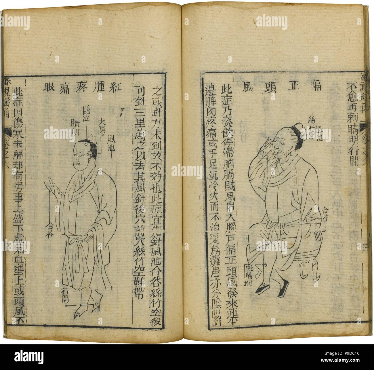 Shen Shi Yao Han (A Precious Book of Ophthalmology). Museum: PRIVATE ...