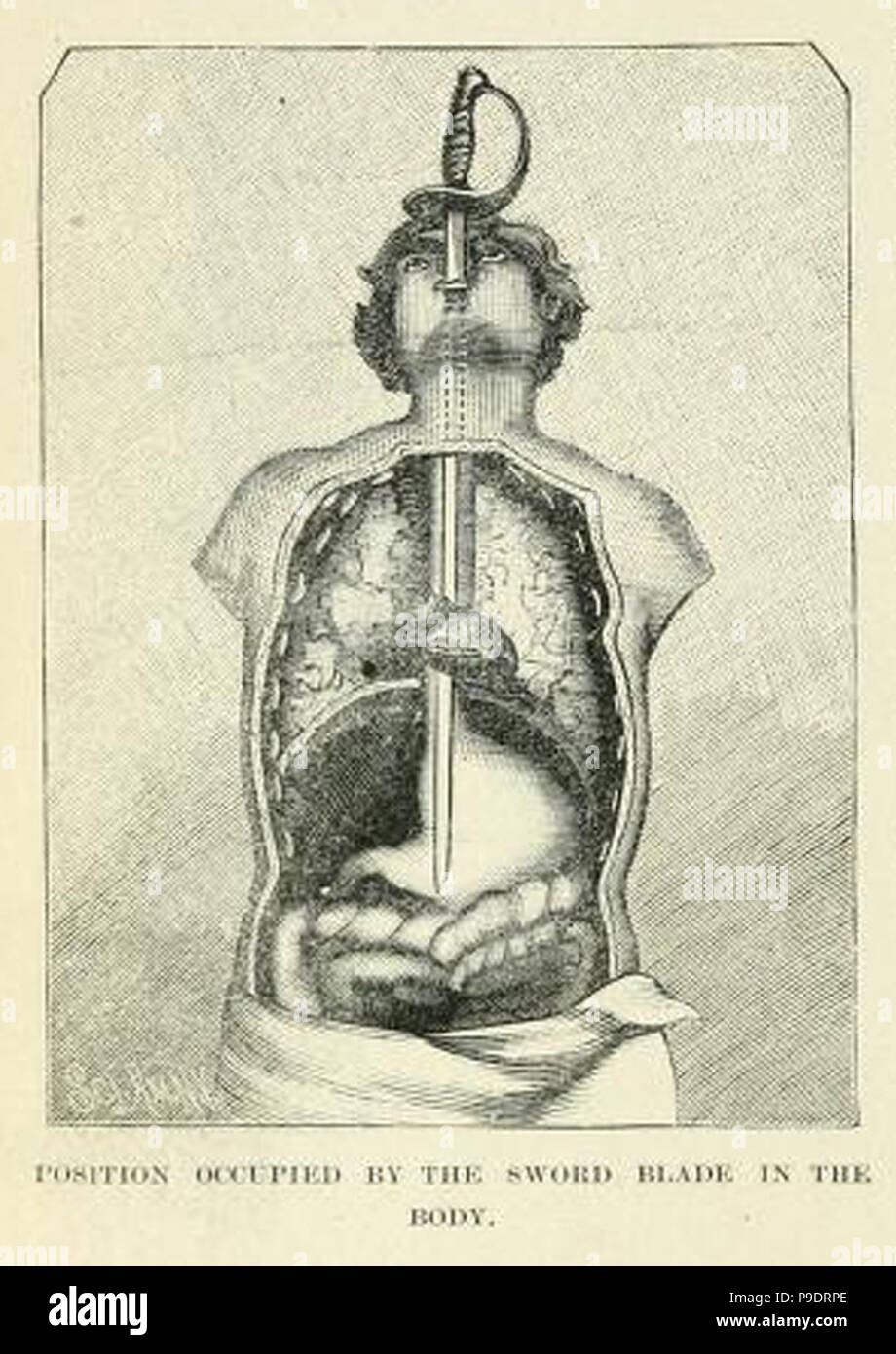 medieval anatomical study Stock Photo - Alamy