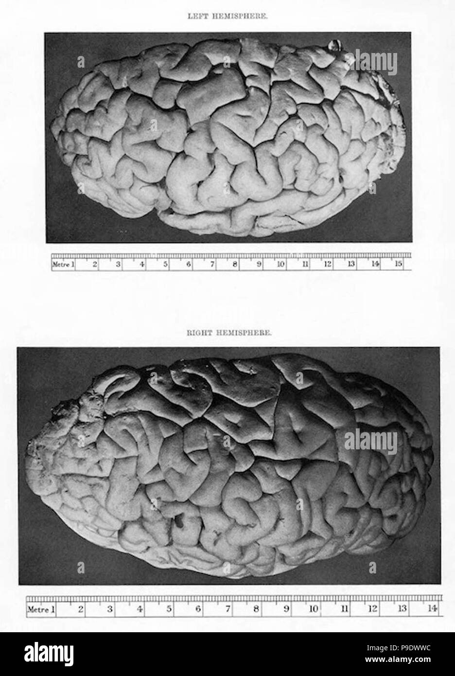 Brain neural pathways Black and White Stock Photos & Images - Alamy