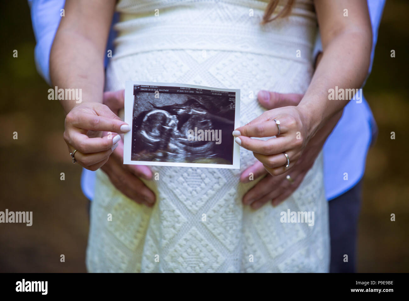 Holding first baby scan hi-res stock photography and images - Alamy