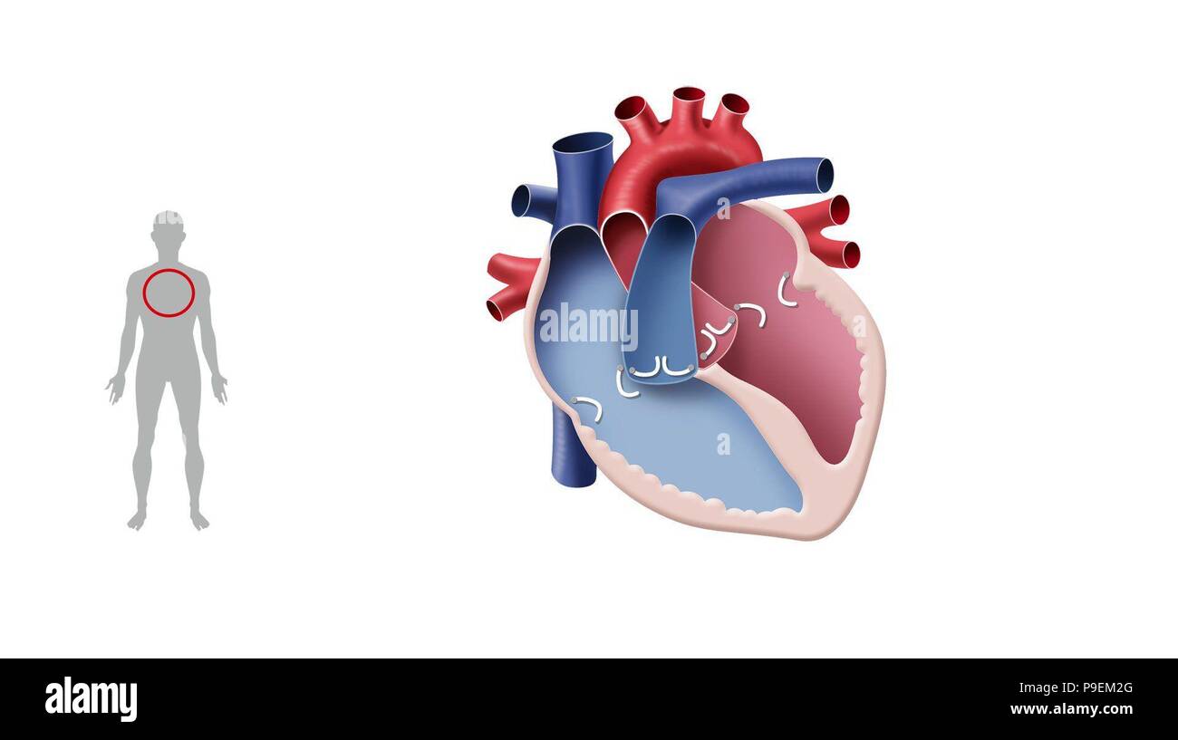 Right atrium Cut Out Stock Images & Pictures - Alamy