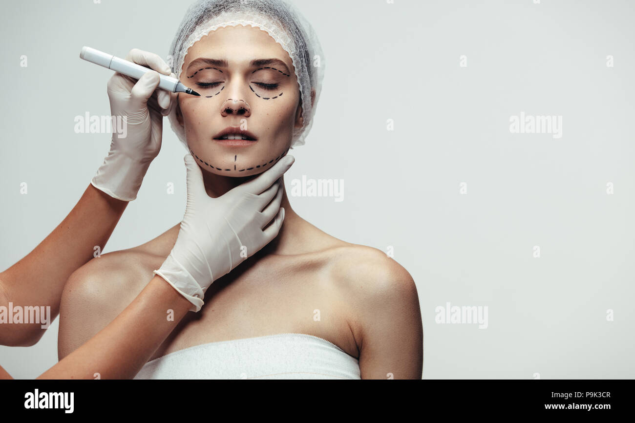 Doctor hands making dotted lines on female face for cosmetic face lift ...