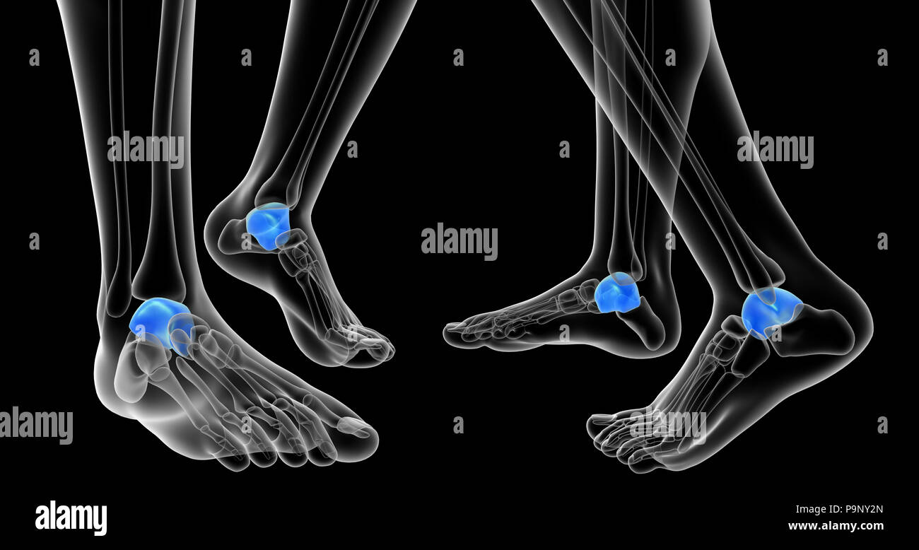 Lateral malleolus fracture hi-res stock photography and images - Alamy