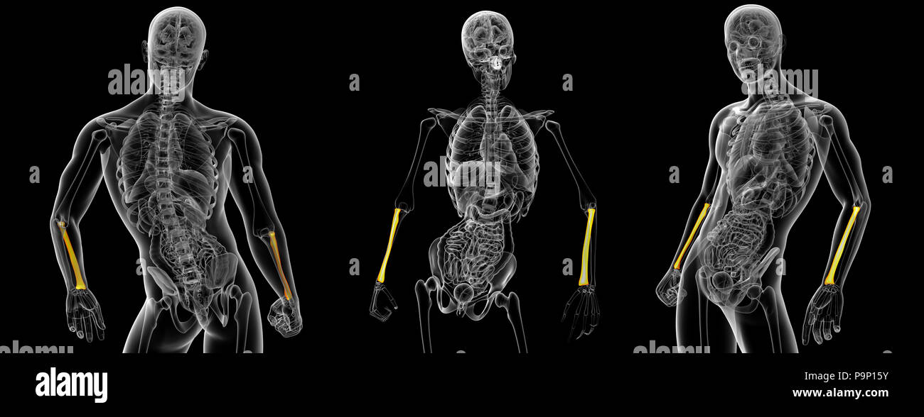 Radius bone hi-res stock photography and images - Alamy