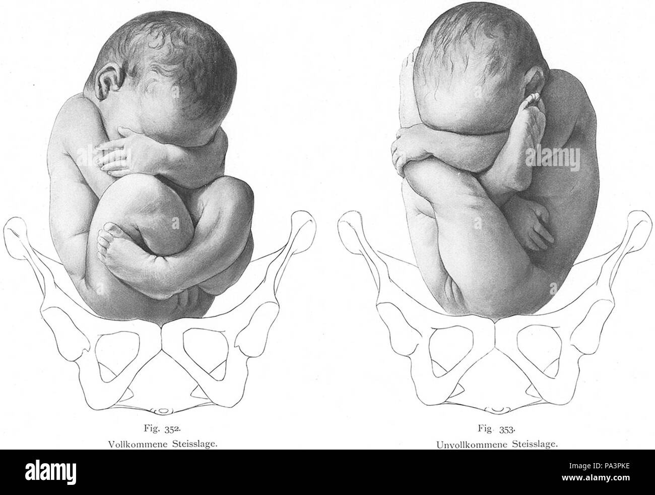 Bumm hi-res stock photography and images - Alamy