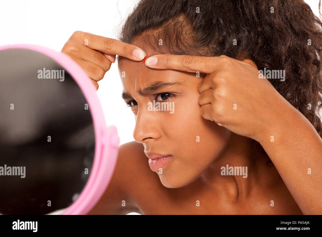 African pimples hi-res stock photography and images - Alamy