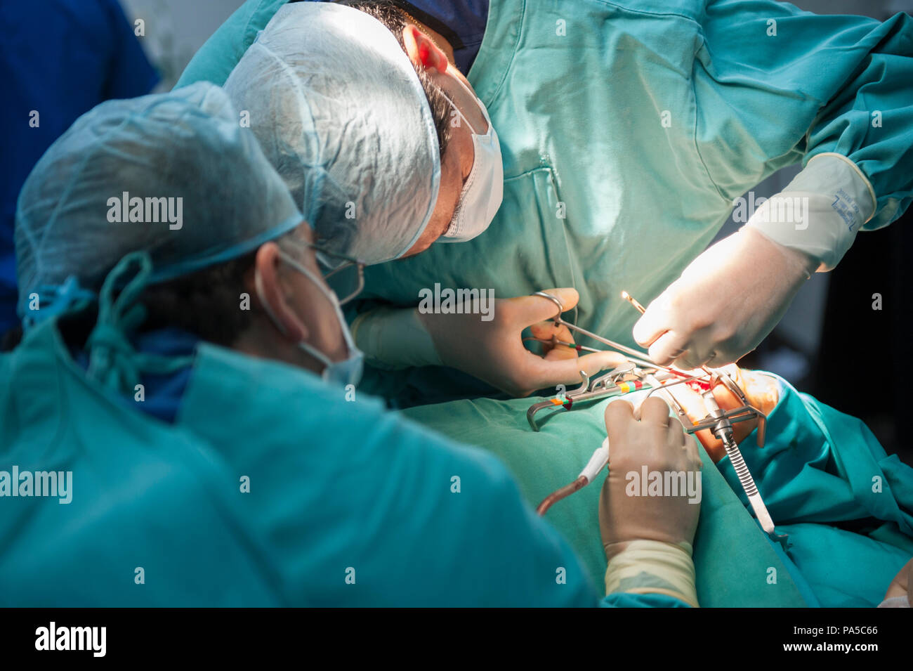 Medical team performing operation Stock Photo - Alamy