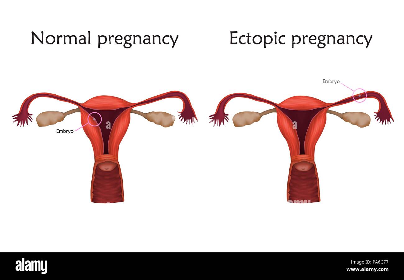 Embryo fallopian tube Cut Out Stock Images & Pictures - Alamy