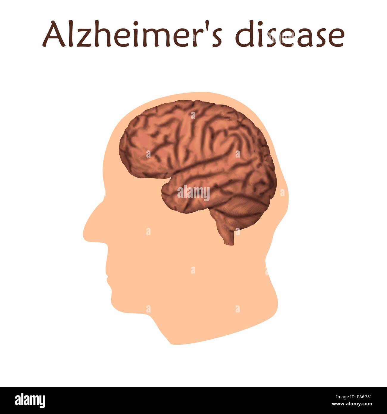Alzheimers disease illustration hi-res stock photography and images - Alamy