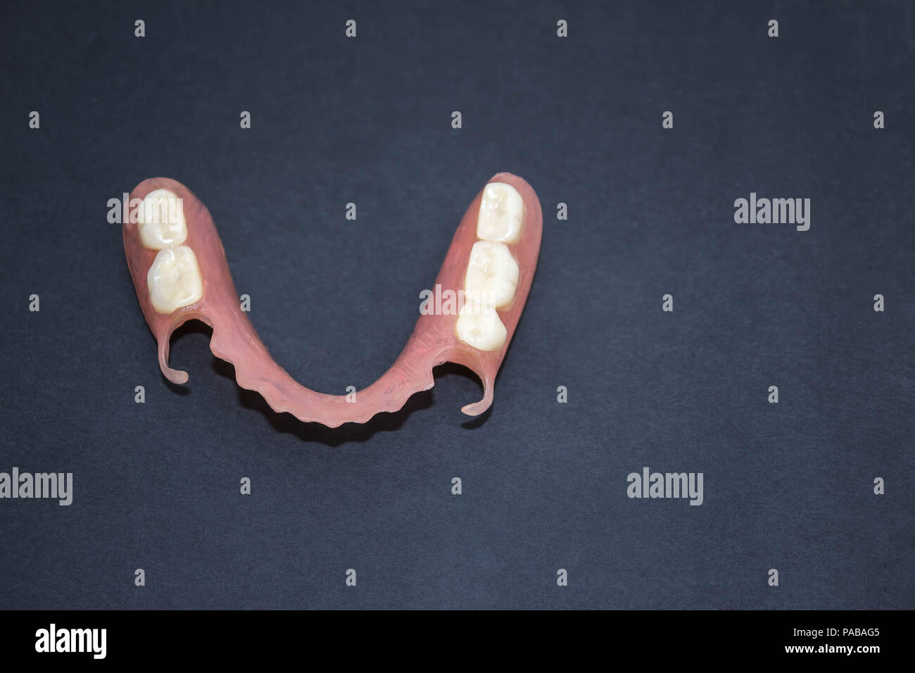 Removable partial denture lower teeth hi-res stock photography and ...