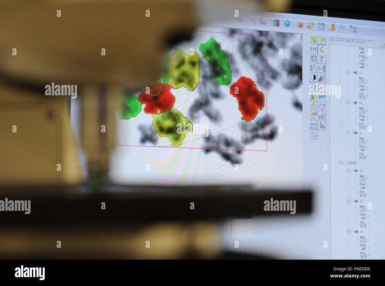 Patient chromosomes are displayed onscreen for Ben Dudte, 81st Medical ...